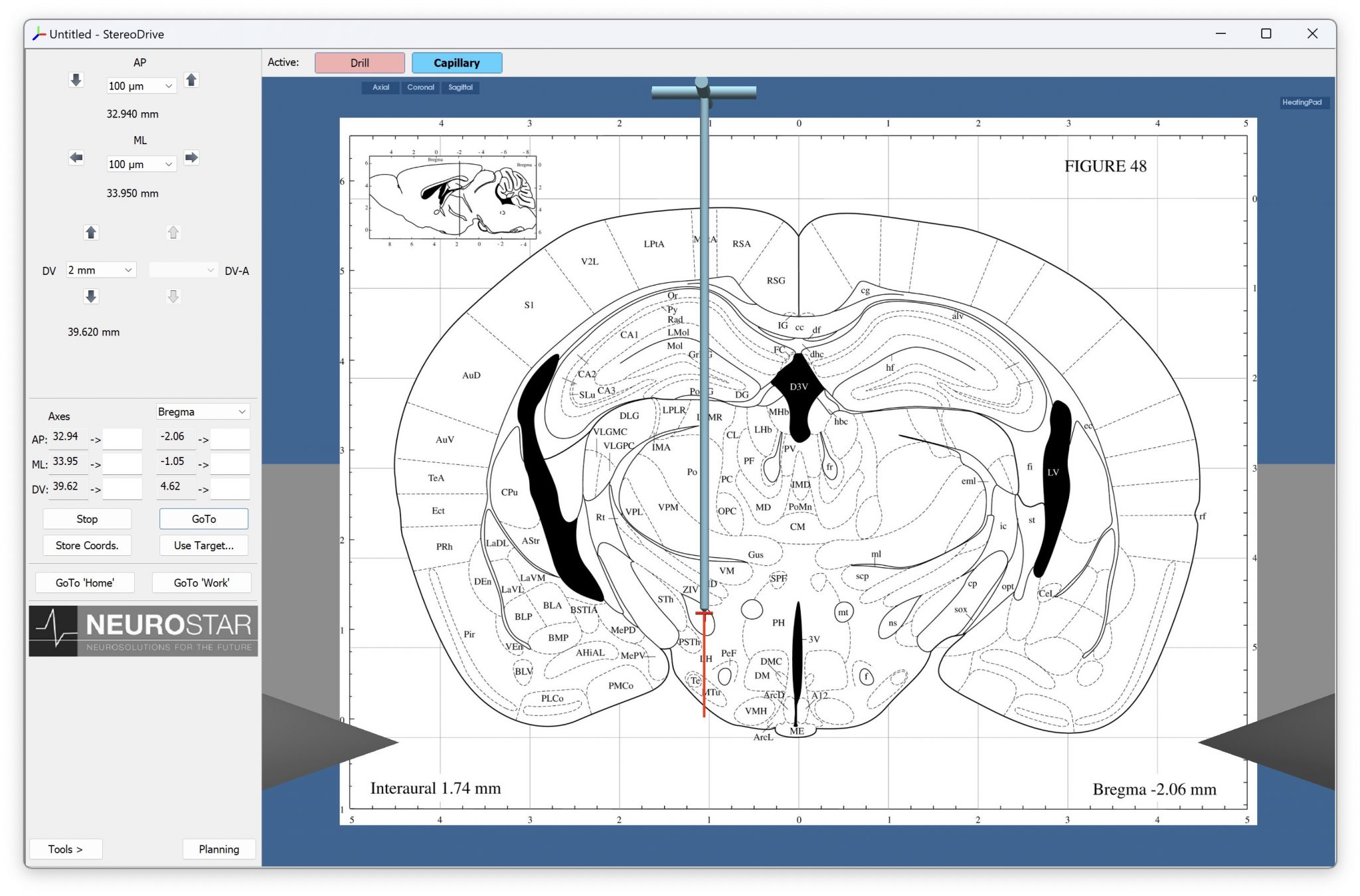 Neurostar-Neurosolutions for the future – Neuroscience, Robot ...