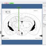 Neurostar-Neurosolutions for the future – Neuroscience, Robot ...
