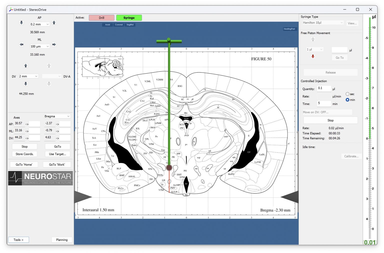 Neurostar-Neurosolutions for the future – Neuroscience, Robot ...