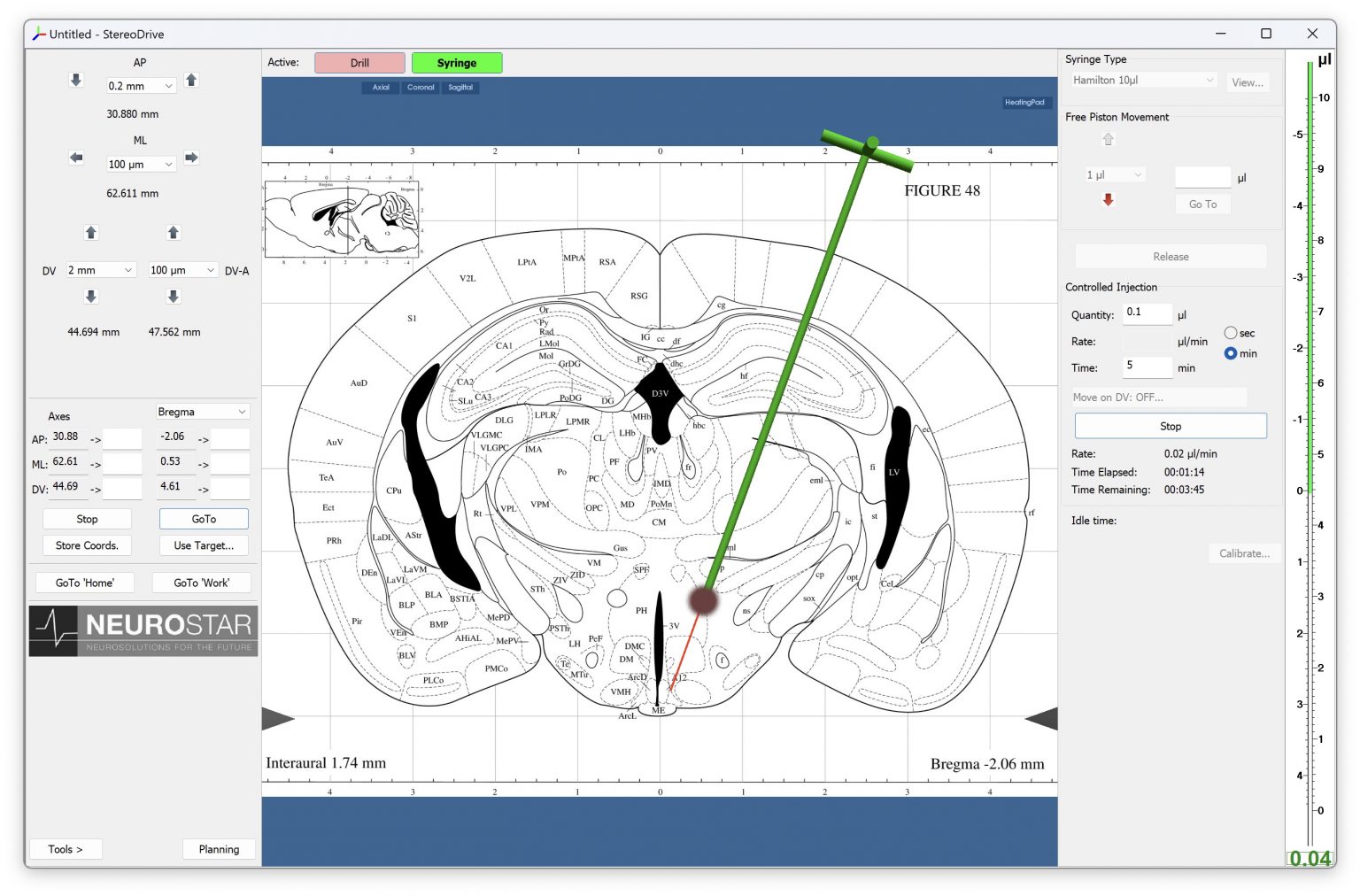 Neurostar-Neurosolutions for the future – Neuroscience, Robot ...