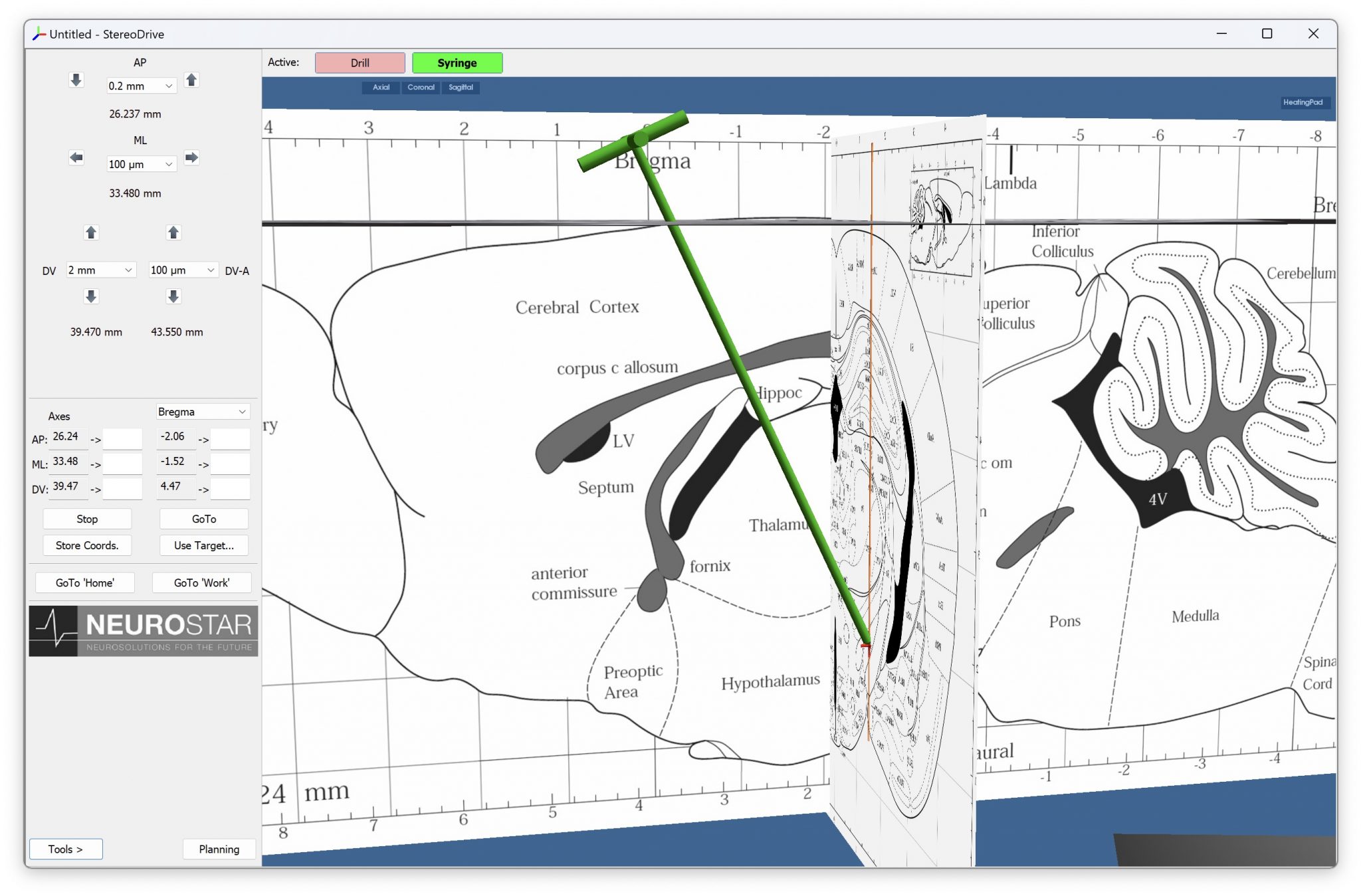 Neurostar-Neurosolutions for the future – Neuroscience, Robot ...