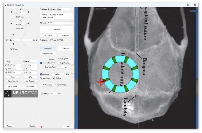 Neurostar-Neurosolutions for the future – Neuroscience, Robot ...
